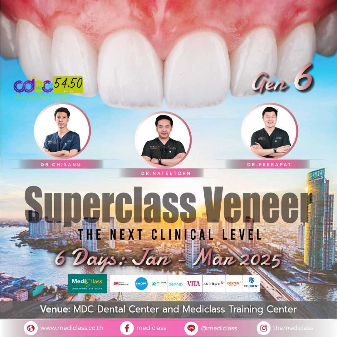 Superclass Veneer Gen 6 | LINE SHOPPING