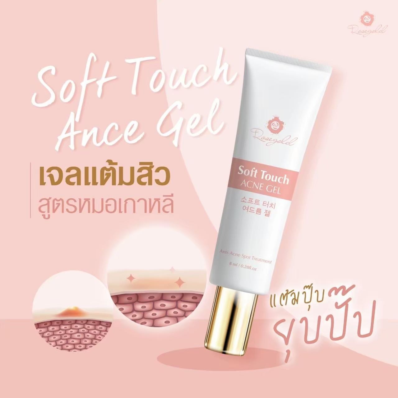 | Soft touch acne gel | LINE SHOPPING
