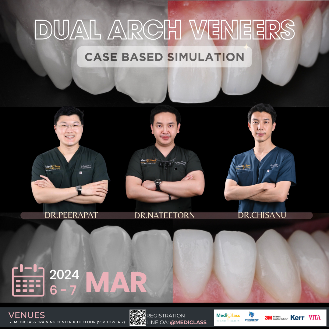 Dual Arch Veneers | LINE SHOPPING